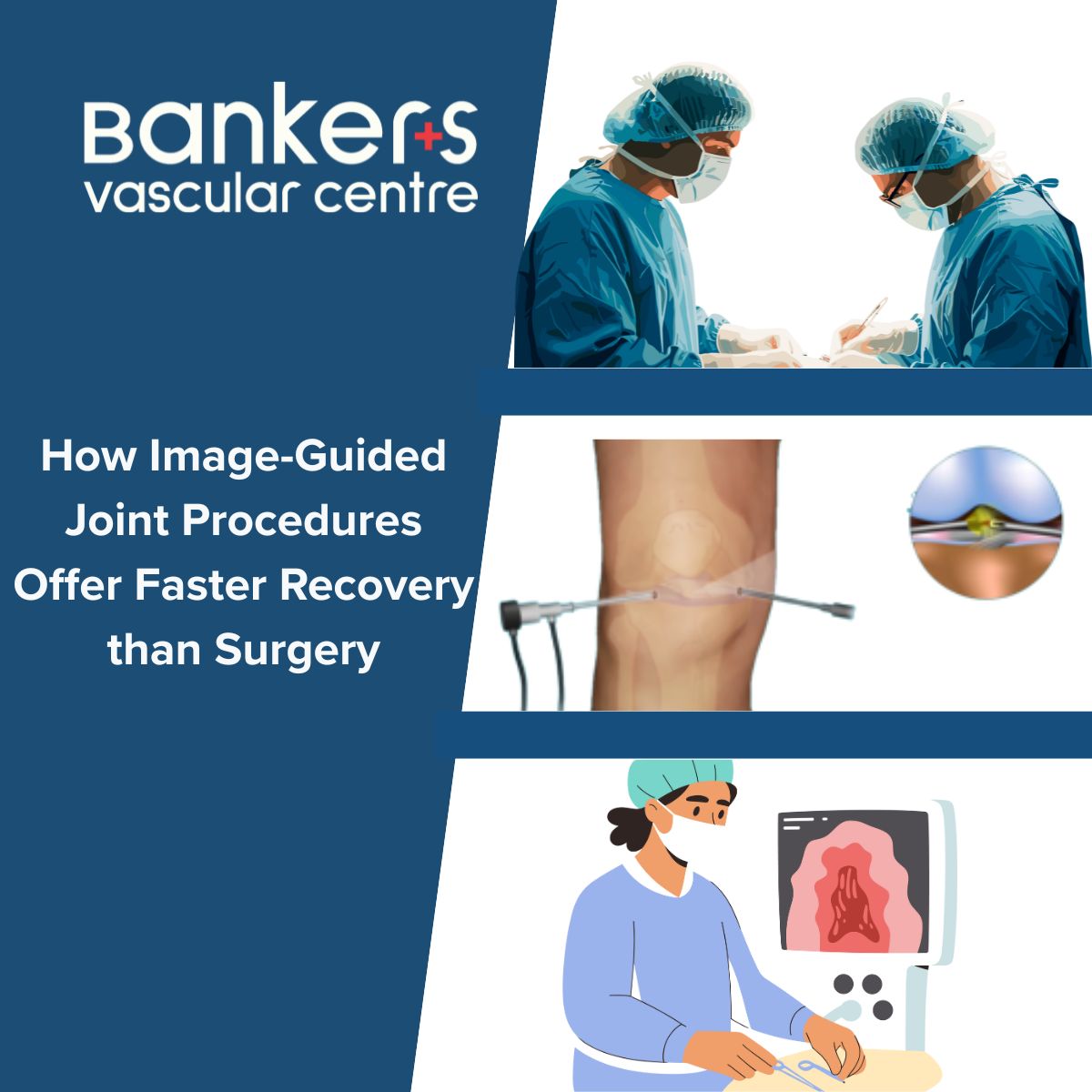 How Image-Guided Joint Procedures Offer Faster Recovery than Surgery | Bankers Vascular Centre ...